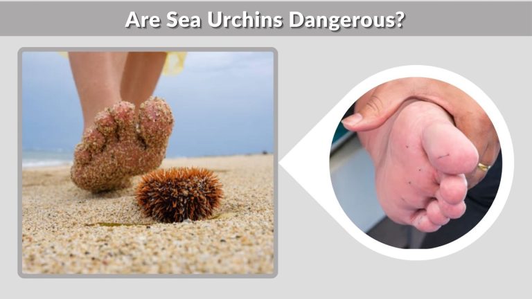 Sea Urchin: Habitat, Anatomy, Diet, and Fascinating Facts