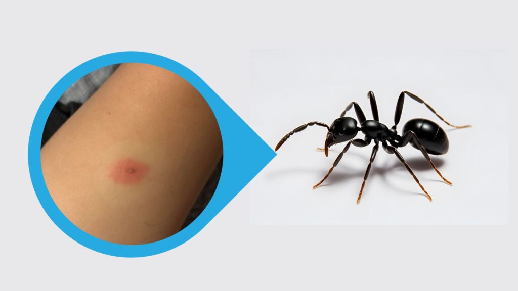 Black Carpenter Ants Size, Bite, Habitat, Facts & Images