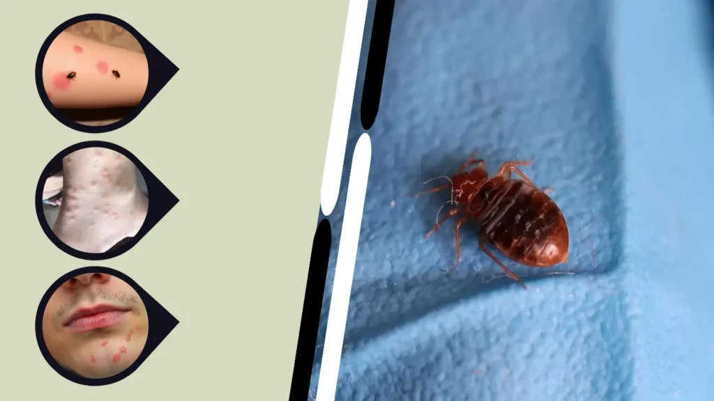 How to Know If You Have Bed Bugs: Signs, Detection Methods