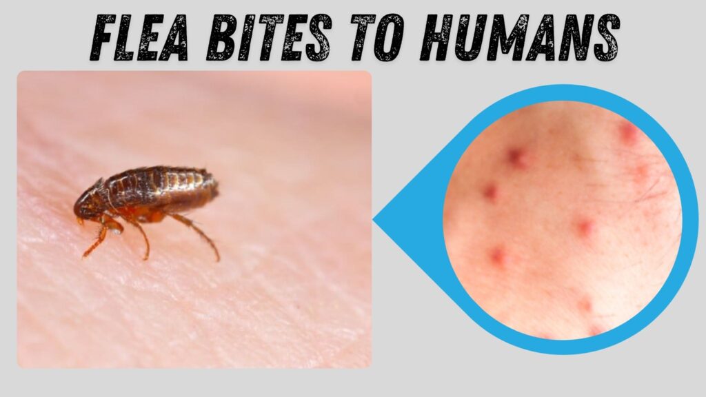 What Do Flea Bites Look Like on Humans? Id with Images