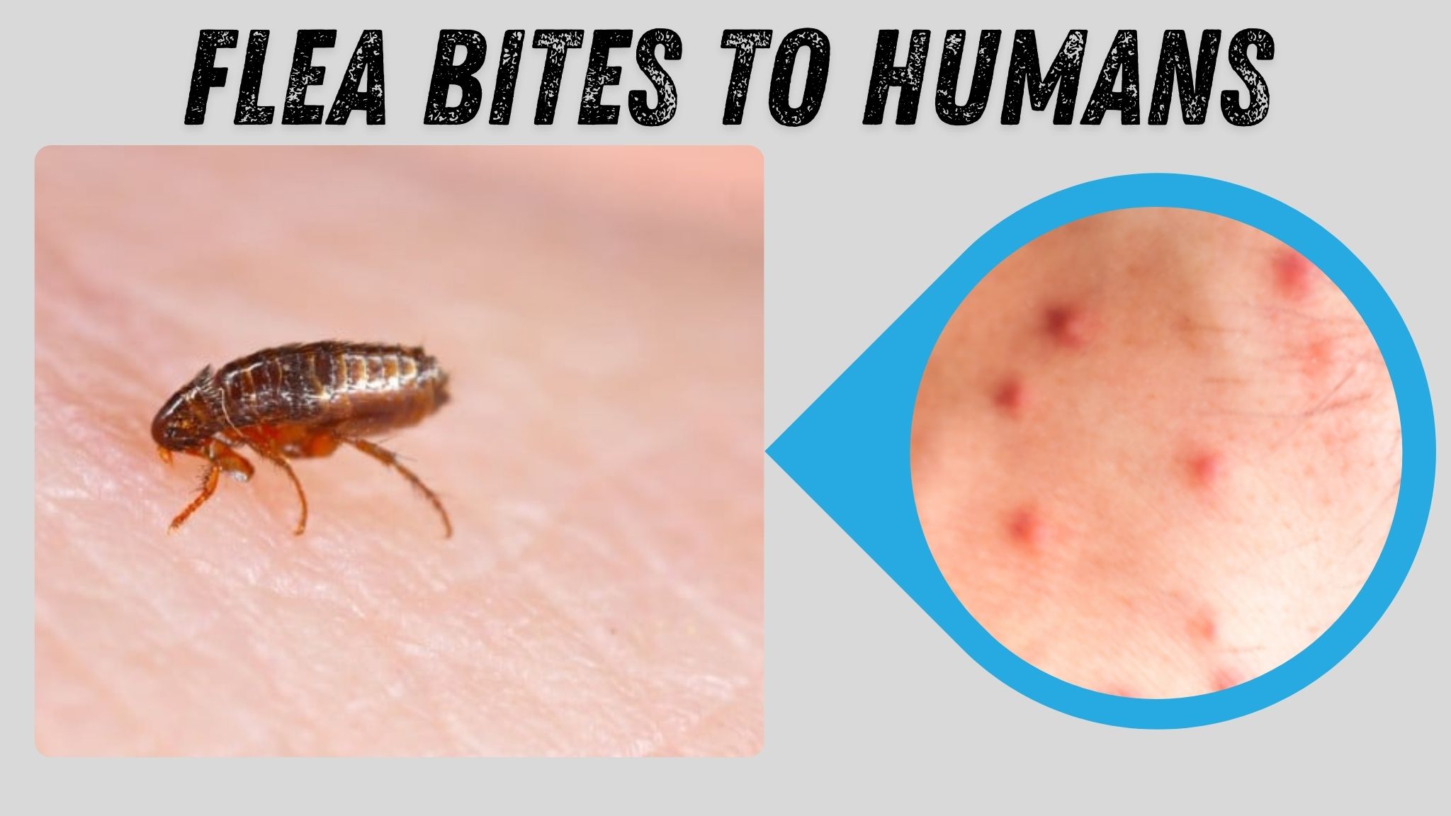 What Do Flea Bites Look Like on Humans? Id with Images