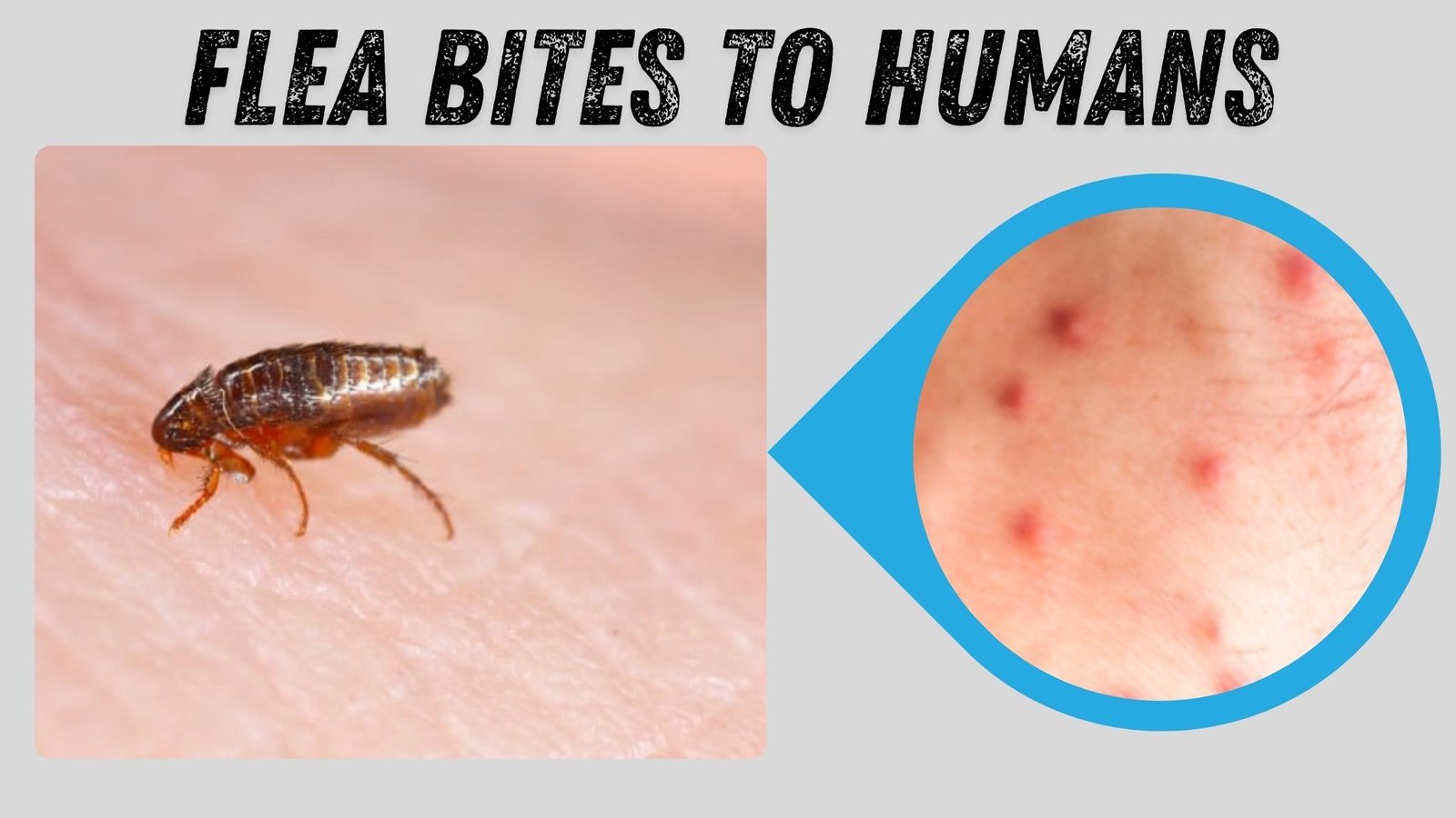 Flea All Insects Flea All Insects