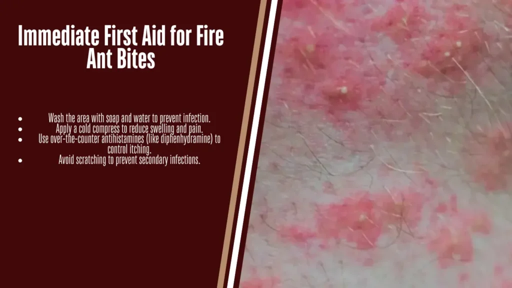 Fire Ant Bites Allergic Reactions: Symptoms With Pictures