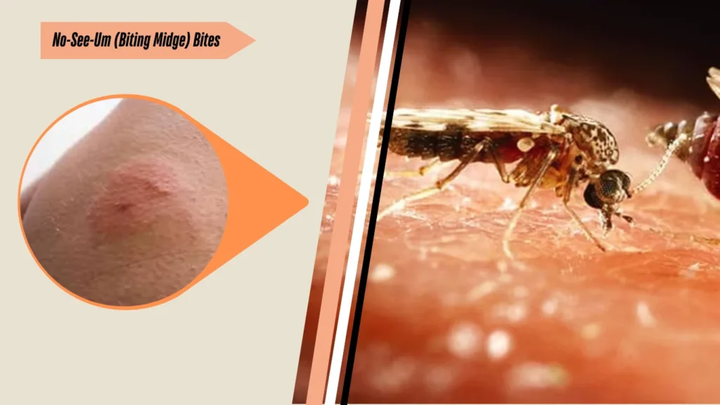 Different Types of Insect Bites: Identification with Picture