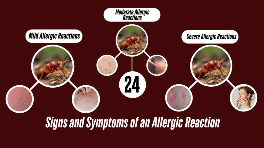 Fire Ant Bites Allergic Reactions: Symptoms With Pictures