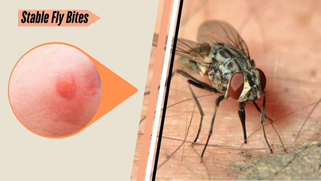 Different Types of Insect Bites: Identification with Picture