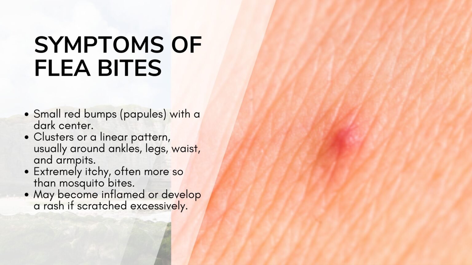 What Do Flea Bites Look Like On Humans Id With Images What Do Flea Bites Look Like On Humans Id With Images