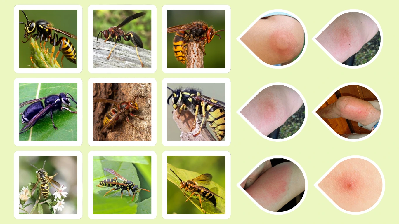 Different Types of Insect Bites: Identification with Picture