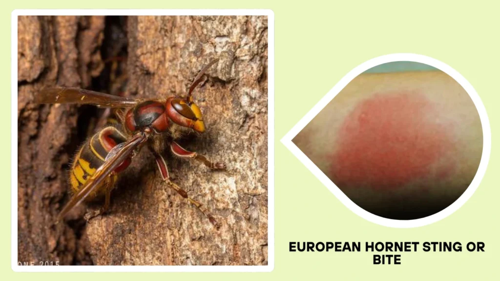 14 Types Of Wasps Sting Or Bite Identification With Images