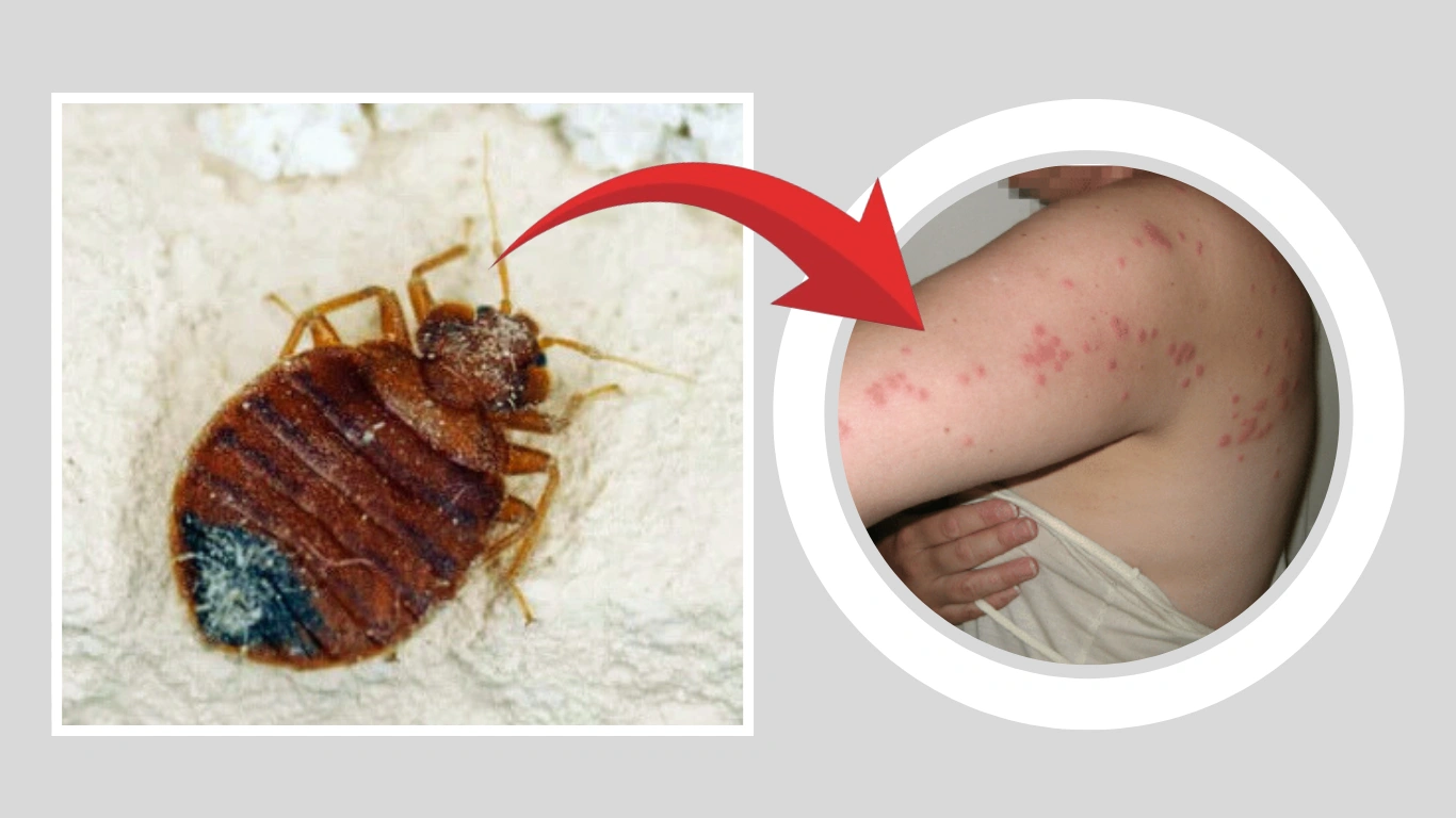 Bed Bug Bite Identification Chart With Pictures
