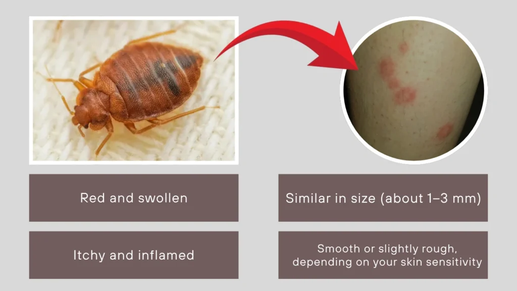 What Do Bed Bug Bites Look Like on Humans? Images