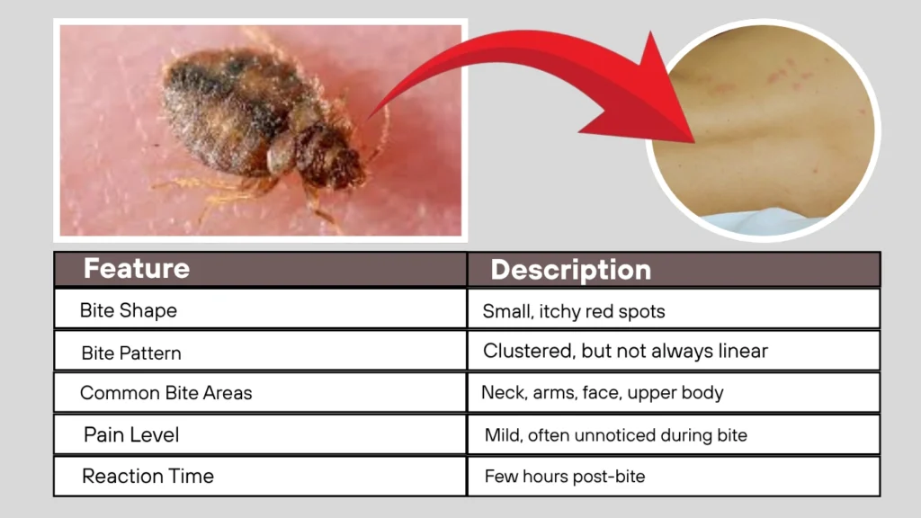 Bed Bug Bite Identification Chart With Pictures