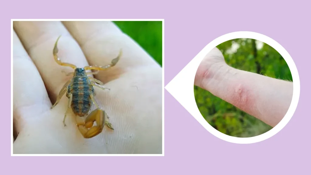 Striped Bark Scorpion: Sting, Identification With Images