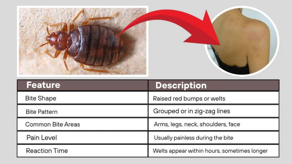 Bed Bug Bite Identification Chart With Pictures