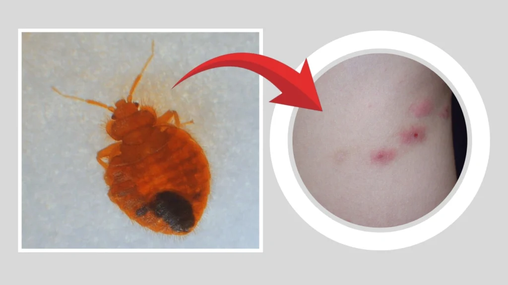 What Do Bed Bug Bites Look Like? Bite Appearance of 12 Different Bed Bugs