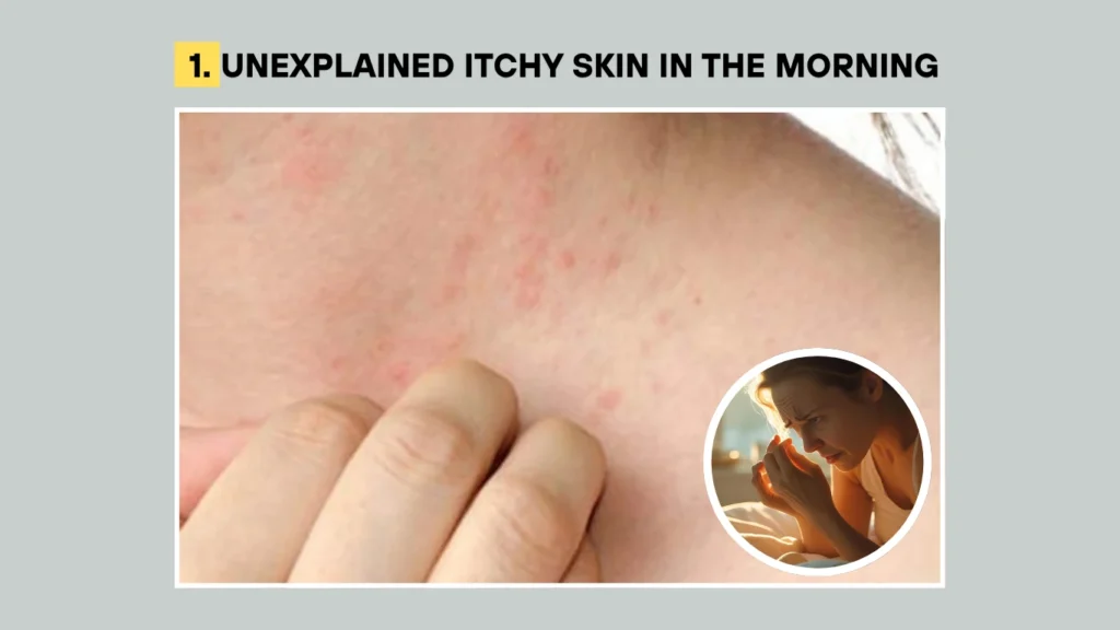 7 Warning Signs of Dust Mites in Your Bed : Bite and Symptom