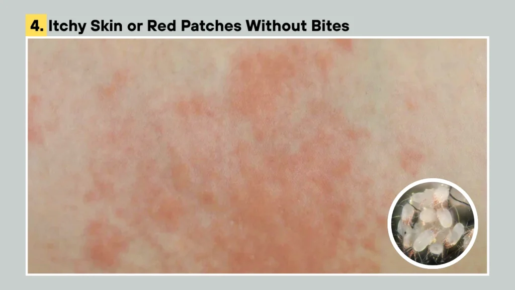 7 Dust Mite Allergy Symptoms You Shouldn’t Ignore