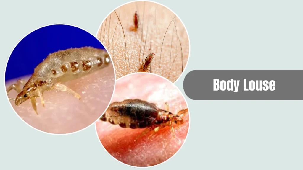 23 Types of Lice: Common Species That Infest Humans, Animals