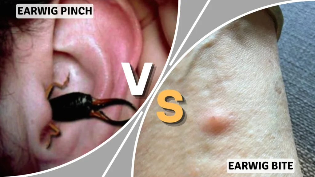 Earwig Bite: Symptoms, Dangers, and How to Treat It