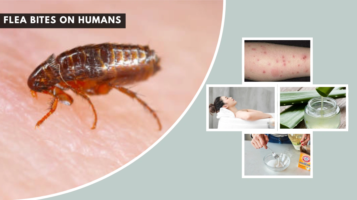 Flea Bites on Humans: Symptoms,Treatment, Pictures
