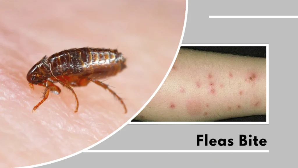 20 Insects That Bite and Sting: Identify the Diferences