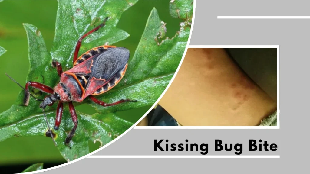 20 Insects That Bite and Sting: Identify the Diferences