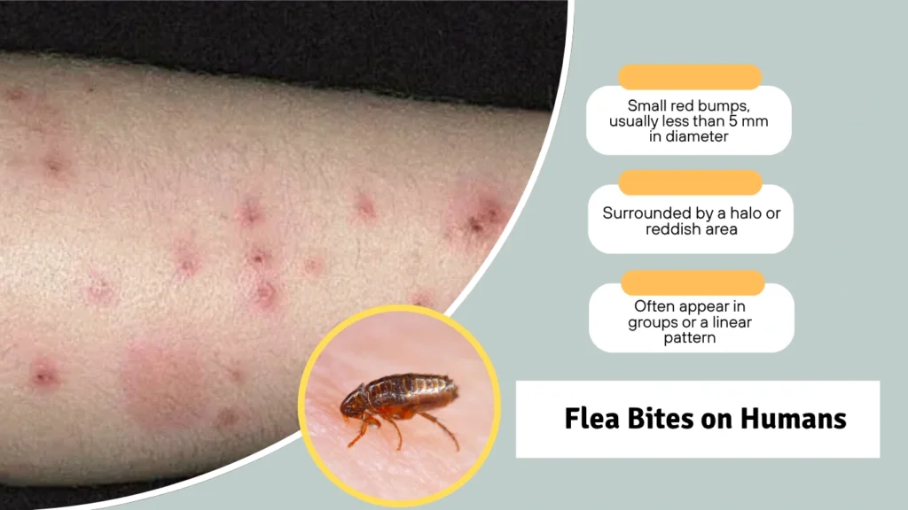 Flea Bites on Humans: Symptoms,Treatment, Pictures