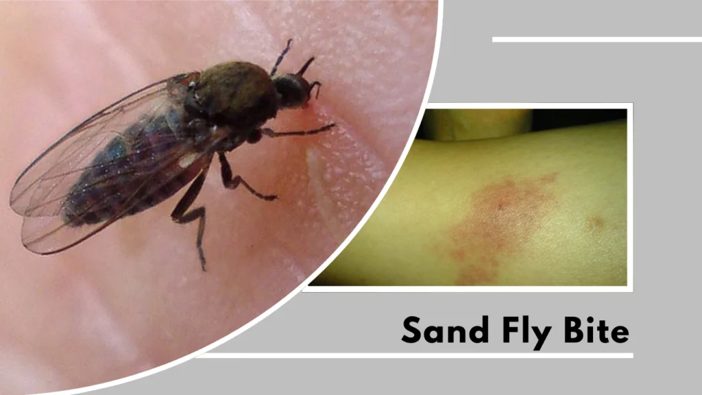 20 Insects That Bite and Sting: Identify the Diferences