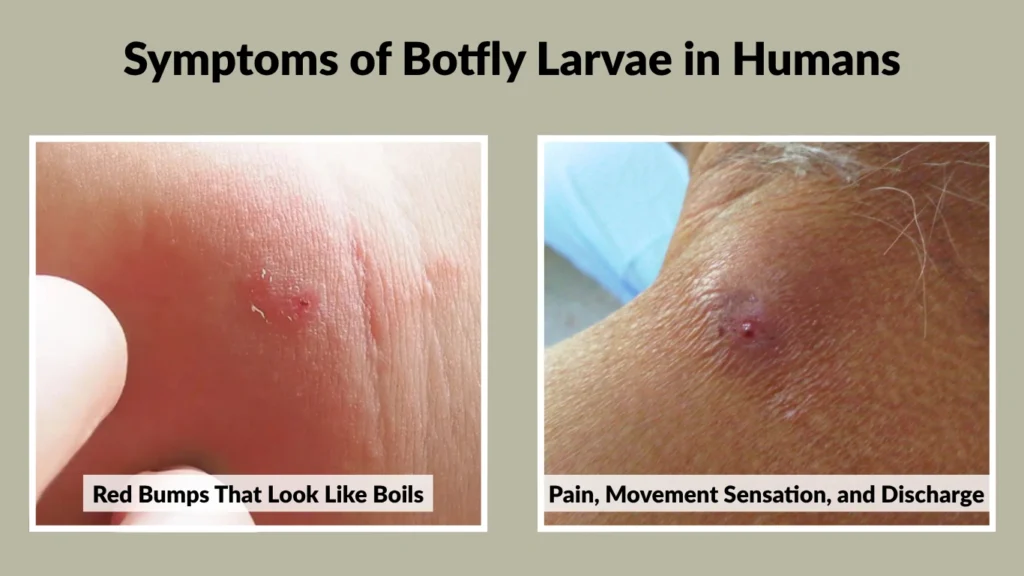 Botfly Larvae: Life Cycle, Symptoms, and Removal Guide