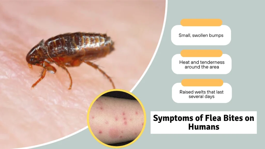 Flea Bites on Humans: Symptoms,Treatment, Pictures