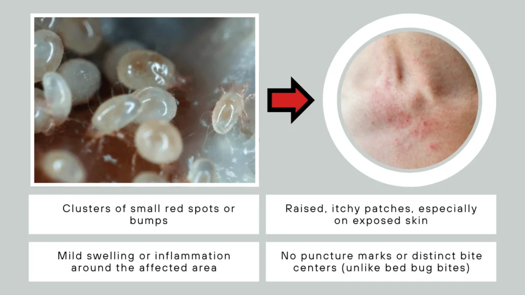 Dust Mite Bites: Symptoms, Identification With Pictures