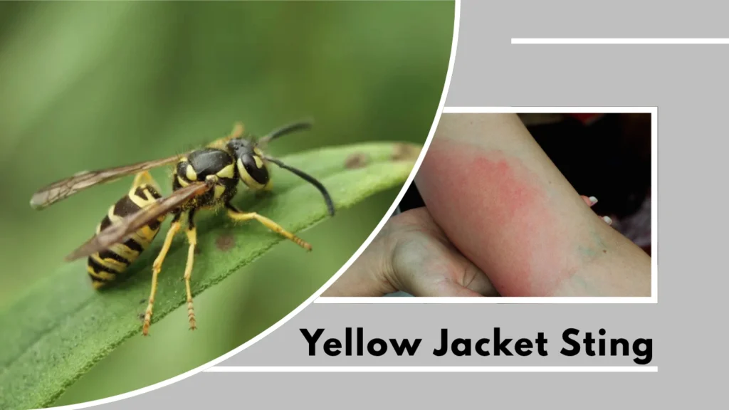 20 Insects That Bite and Sting: Identify the Diferences