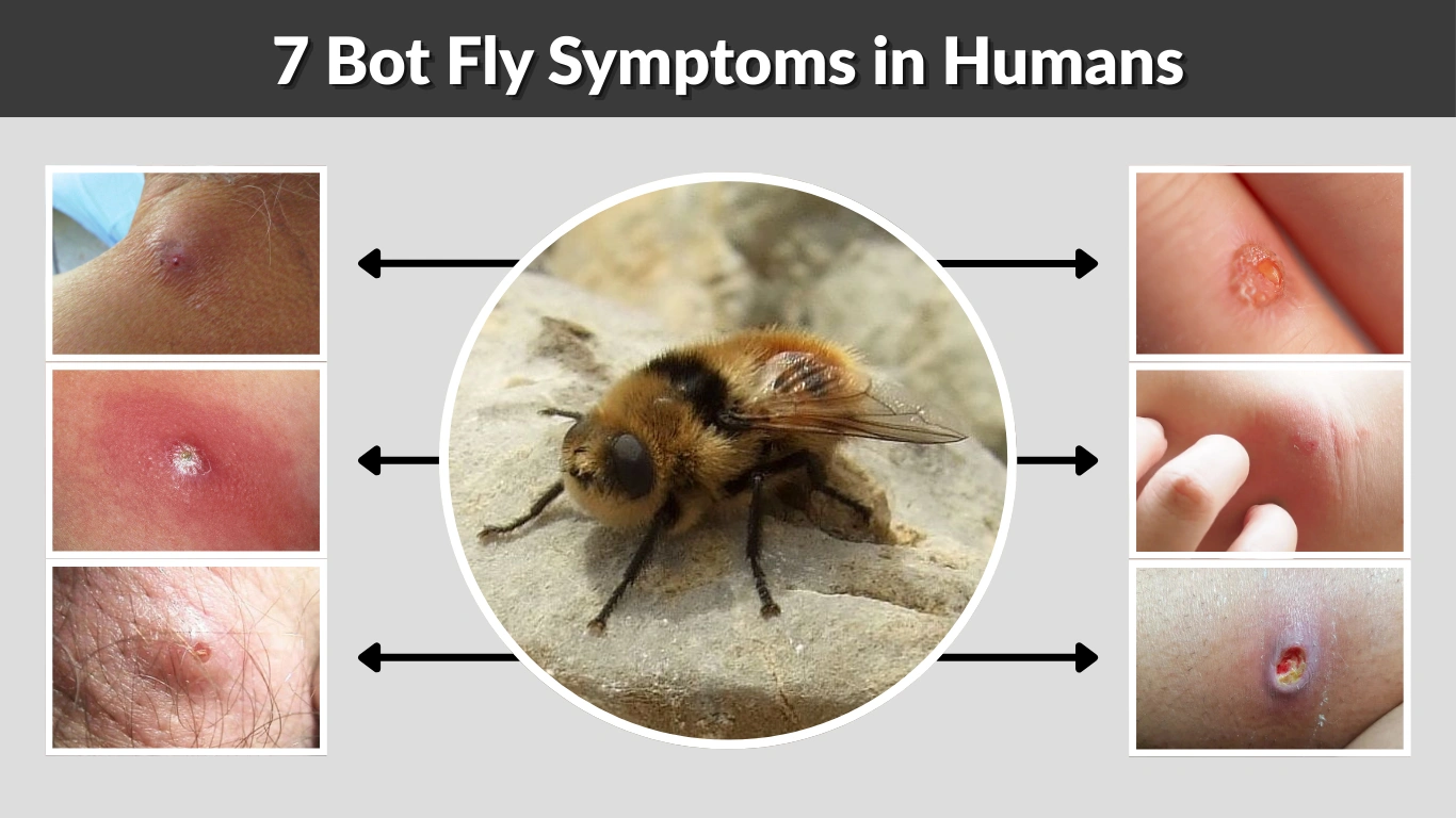 7 Bot Fly Symptoms in Humans: You Must Know