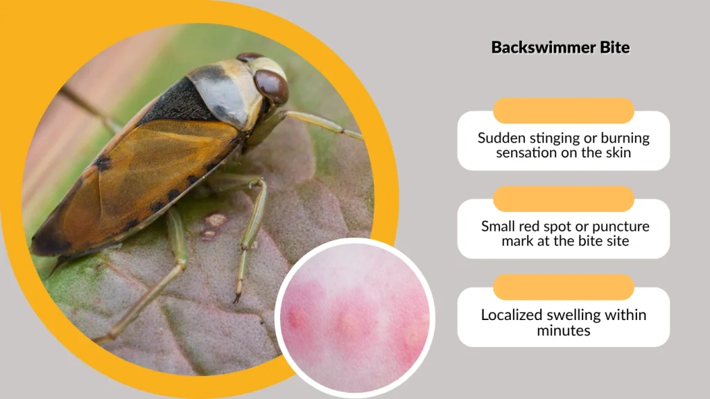 5 Types of Water Bug Bites: Identification, Symptoms, Prevention
