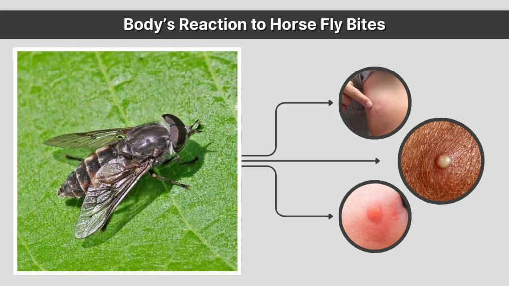 Horse Fly Bites on Humans: Symptoms, Reaction, and Treatment