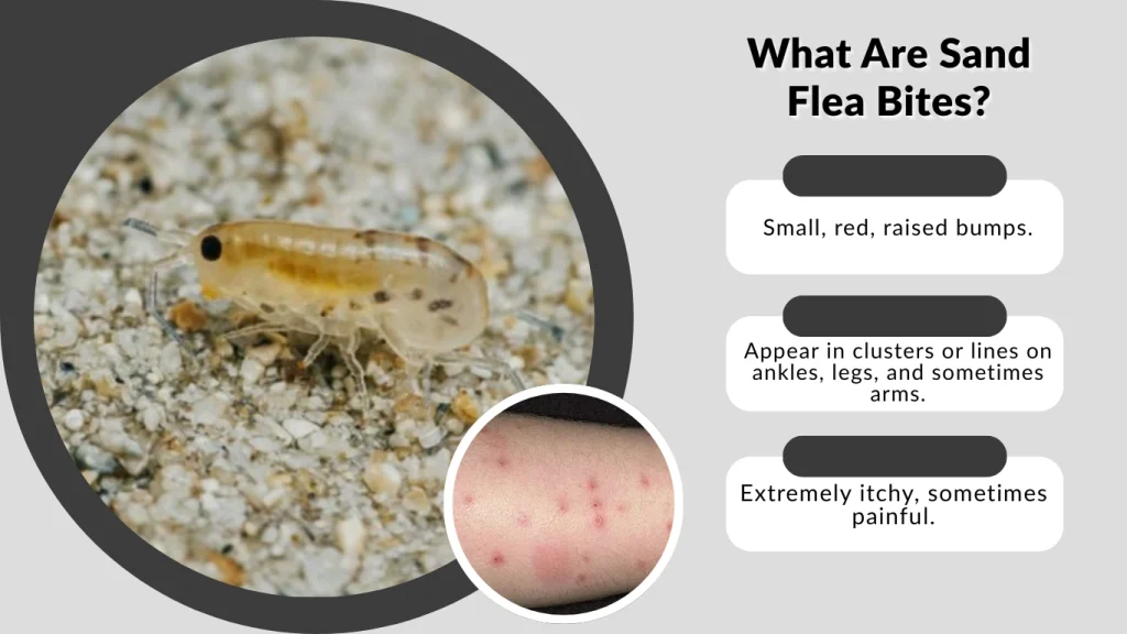 How Long Do Sand Flea Bites Last? (Timeline, Symptoms & Relief)