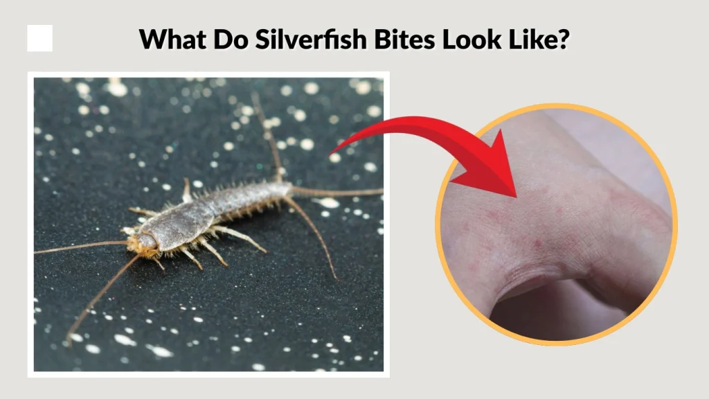 Silverfish Bite: Symptoms, Identification, and Treatment