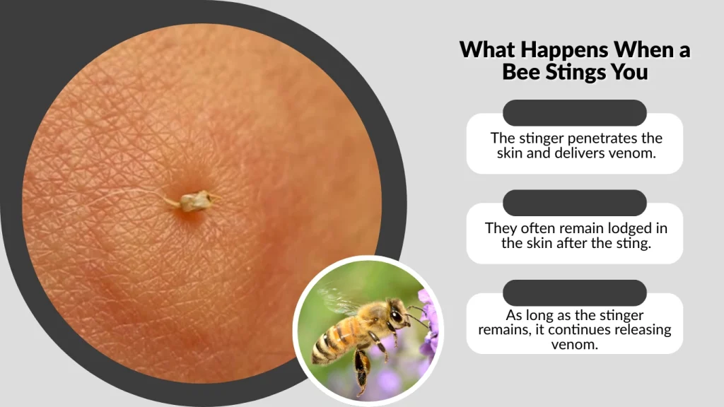 Bee Sting Treatment: 9 Home Remedies for Quick Relief