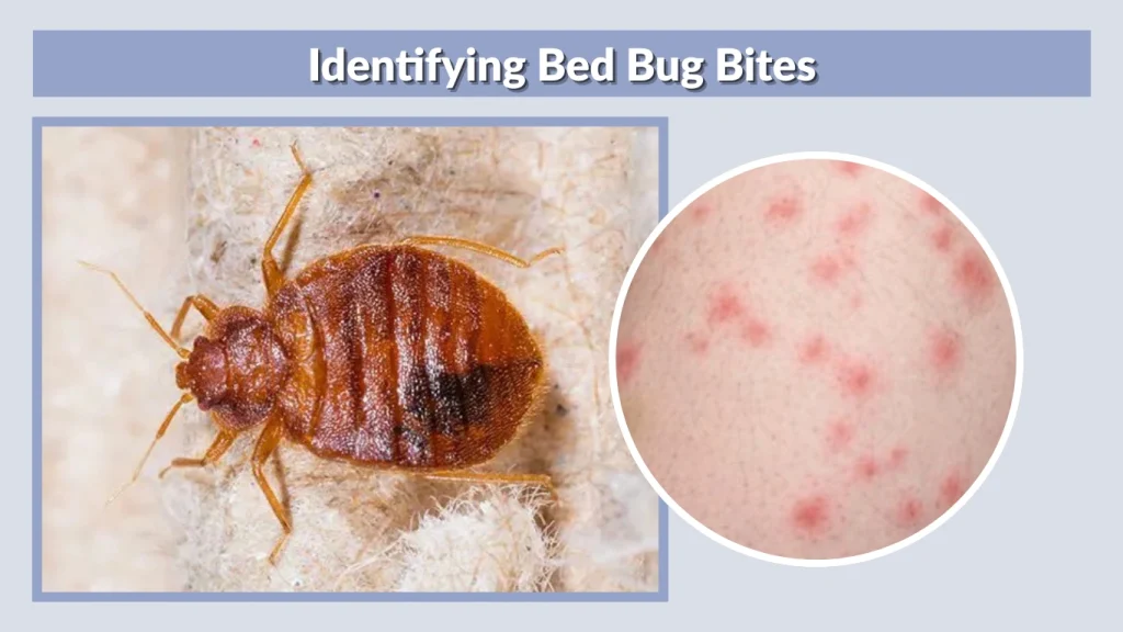 Bed Bug Bite Treatments: Complete Guide to Relief, Recovery, and Prevention
