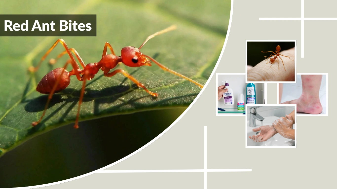 Red Ant Bites: Symptoms, Treatment, and Prevention Guide