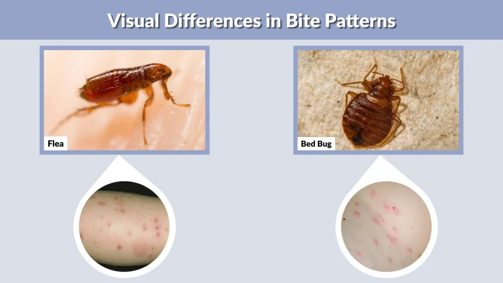 Flea Bites vs Bed Bug Bites: Key Differences & Identification
