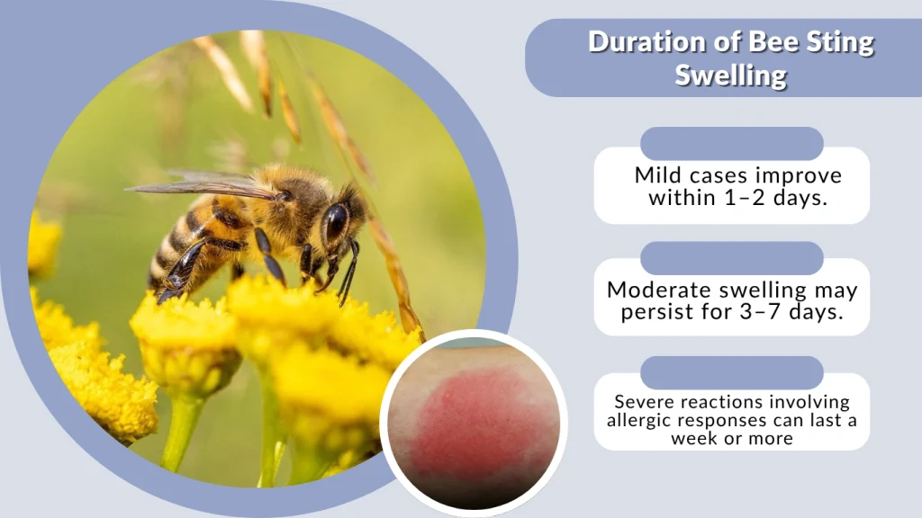 Bee Sting Swelling Treatment Quickly (With Natural Remedies)
