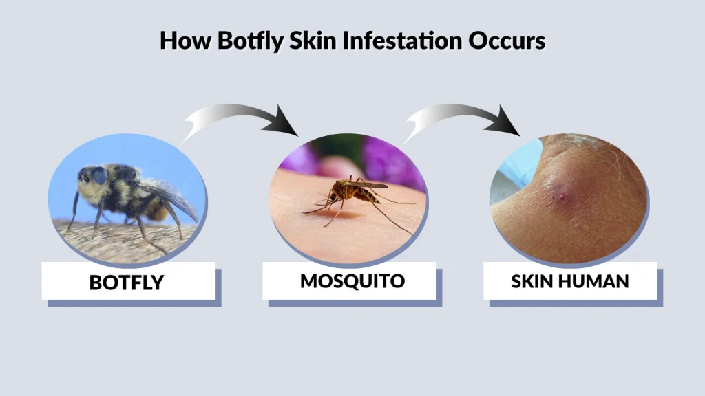Skin Human Botfly Infestation: Causes, Symptoms, and Treatment