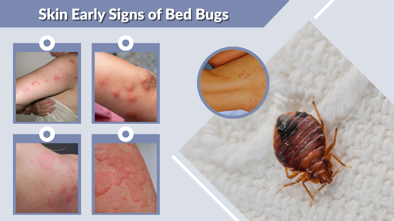 Skin Early Signs of Bed Bugs: Different Stage Indicators