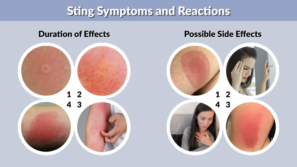 Tarantula Hawk Wasp Sting: Pain, Symptoms, and Treatment