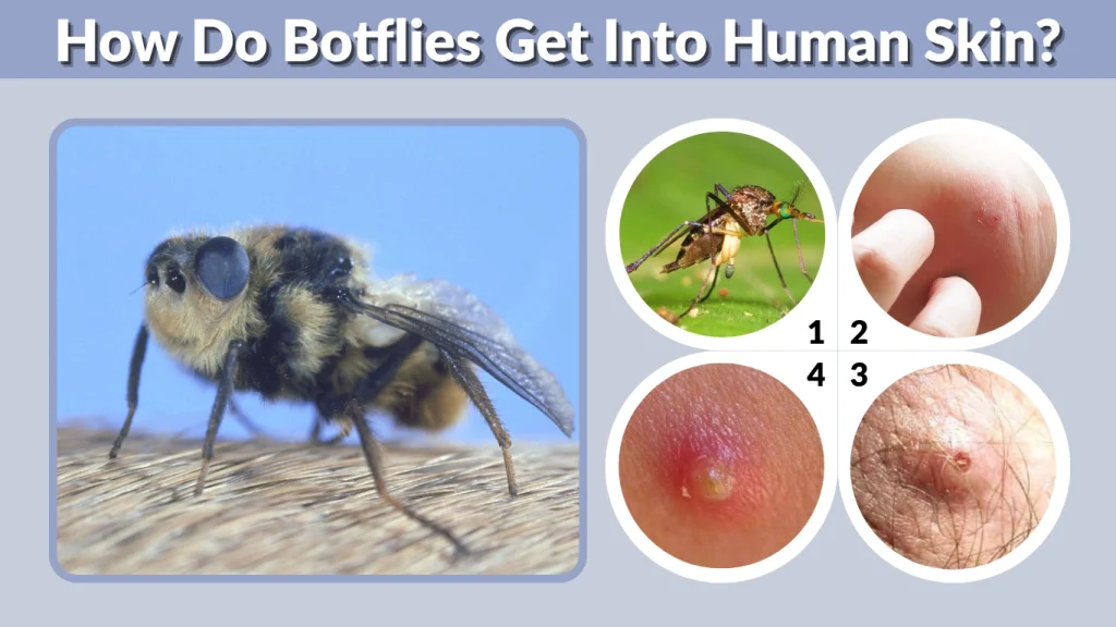 Botfly in Skin: Causes, Symptoms, and Complete Removal Guide