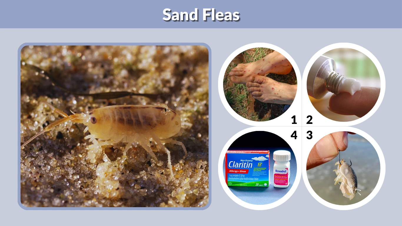 Sand Fleas: Identification, Bites, Treatment & Removal
