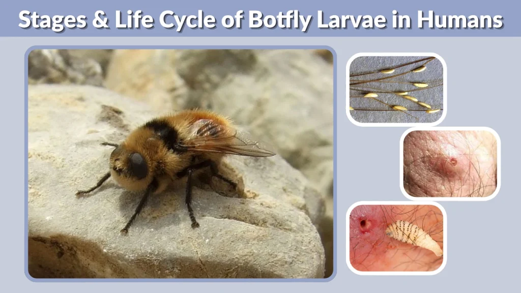 Botfly Infestation in Humans: Causes, Symptoms & Treatment