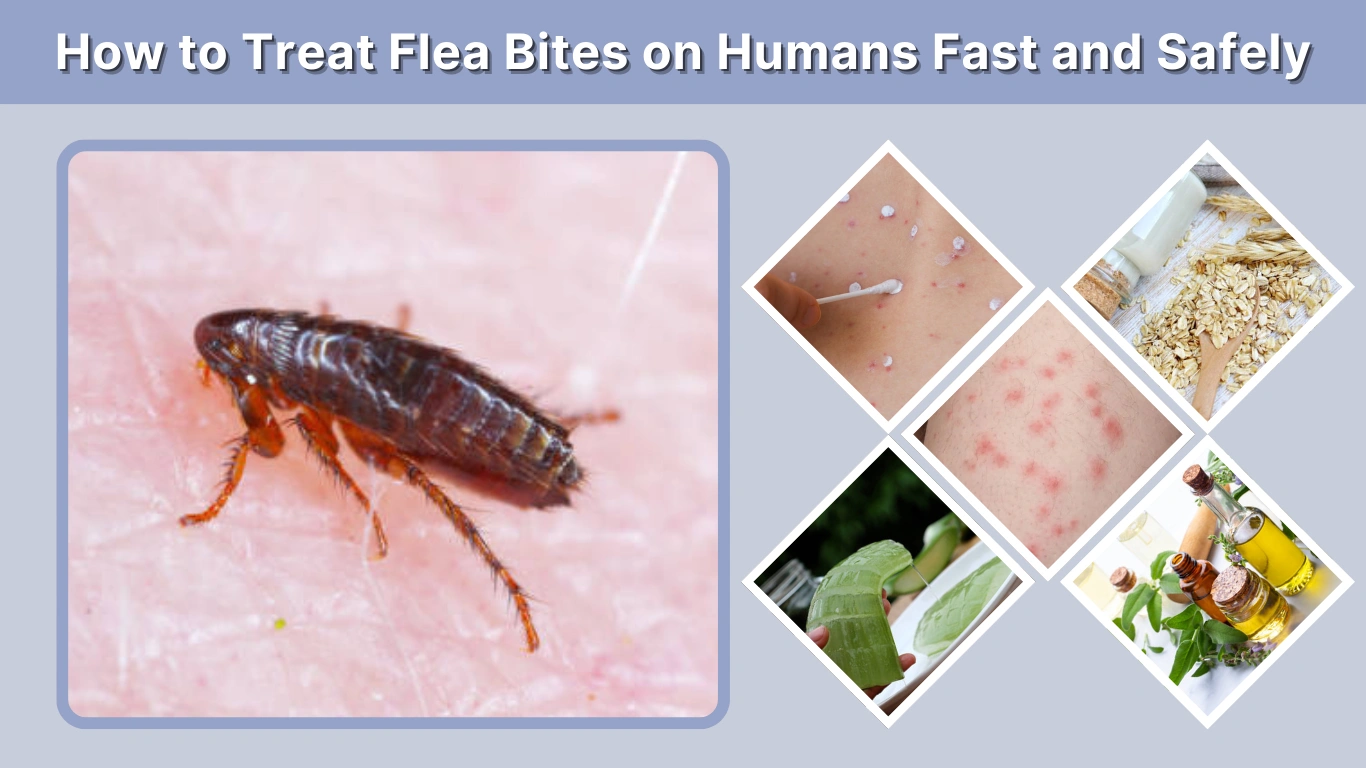 How to Treat Flea Bites on Humans Fast and Safely