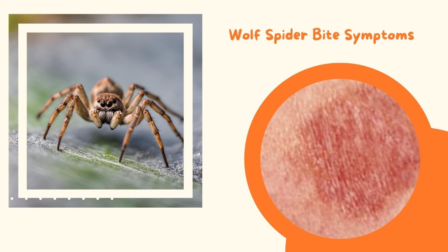 17 Types of spider bite symptoms (ID with pictures)